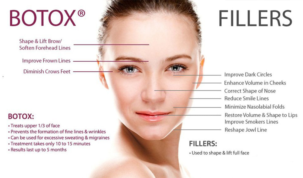 Fillers and Botox – Angels Aesthetics